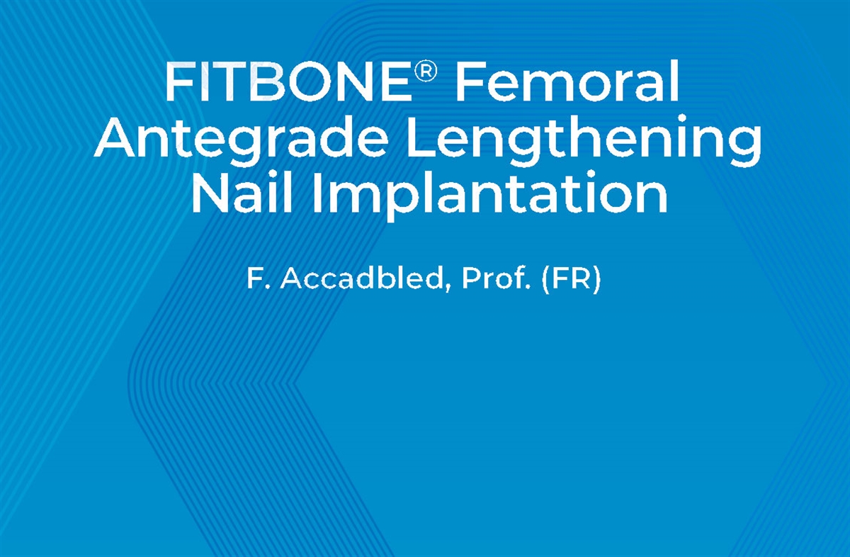 Fitbone Femoral Antegrade Lengthening Nail Implantation