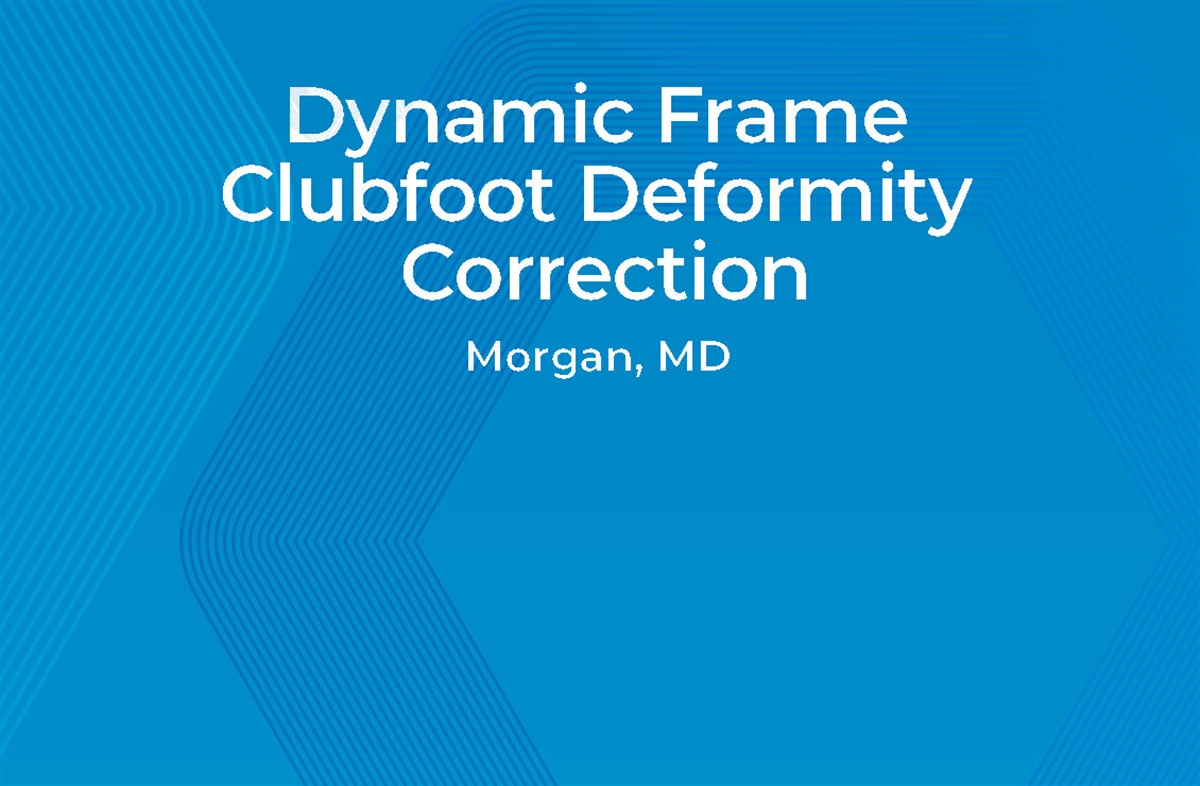 Dynamic Frame Clubfoot Deformity Correction