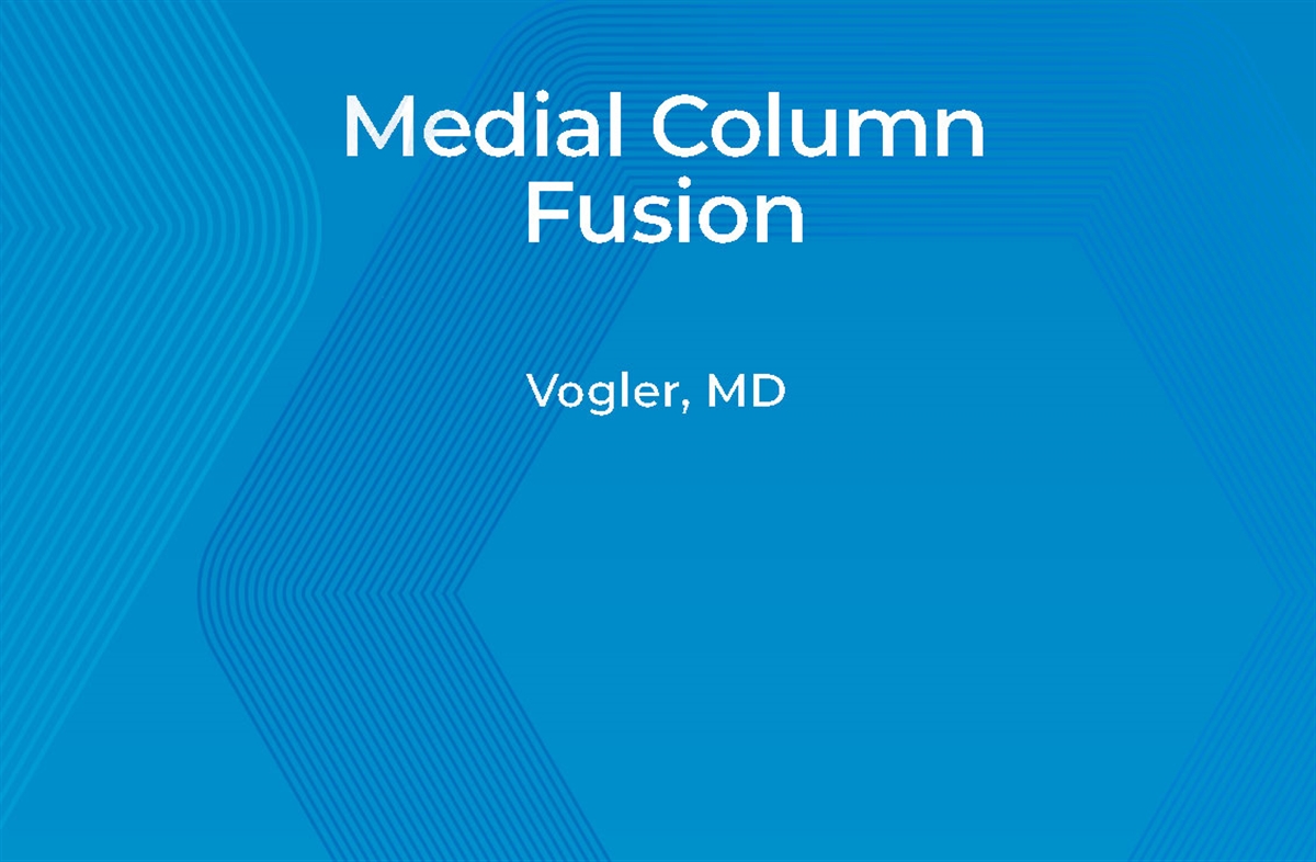 Medial Column Fusion