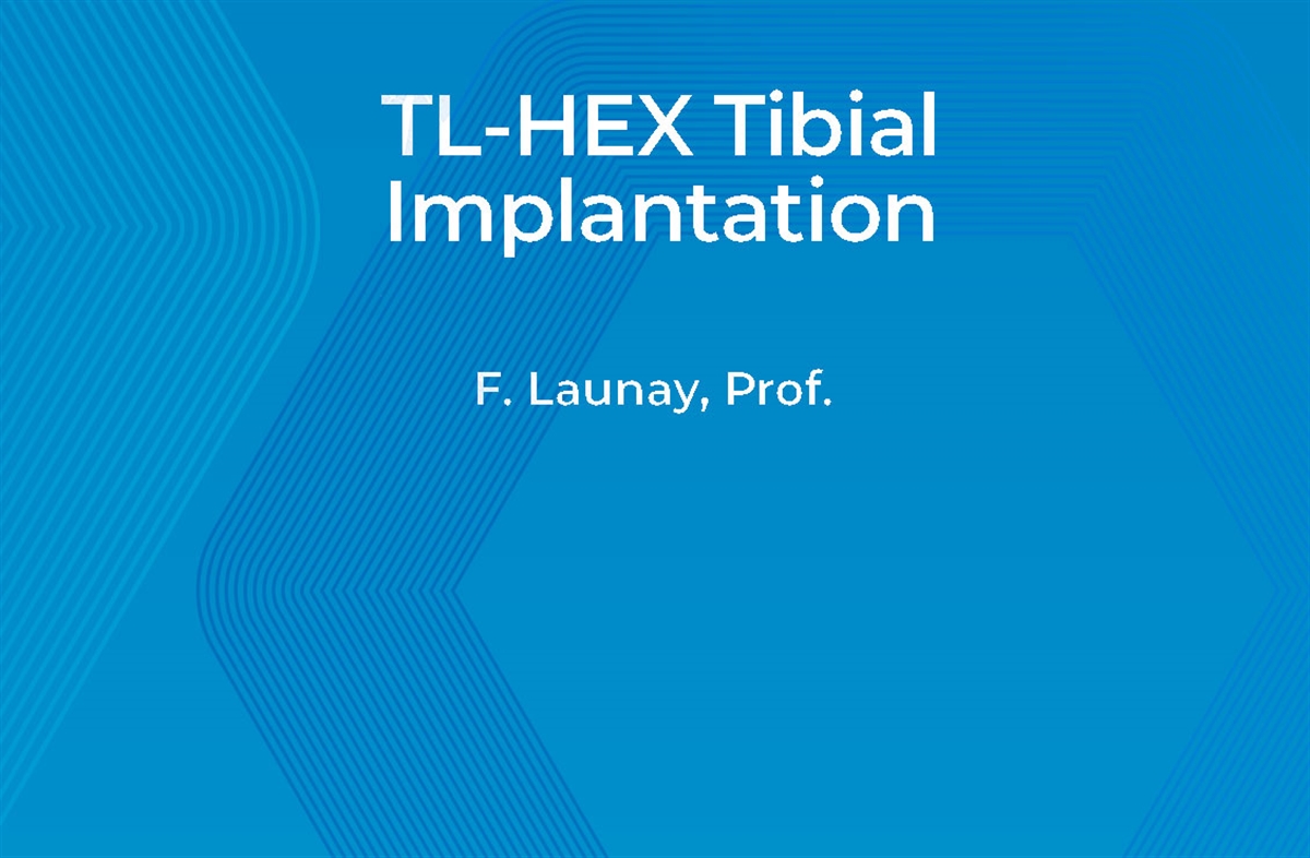 TL-Hex Tibial Implantation