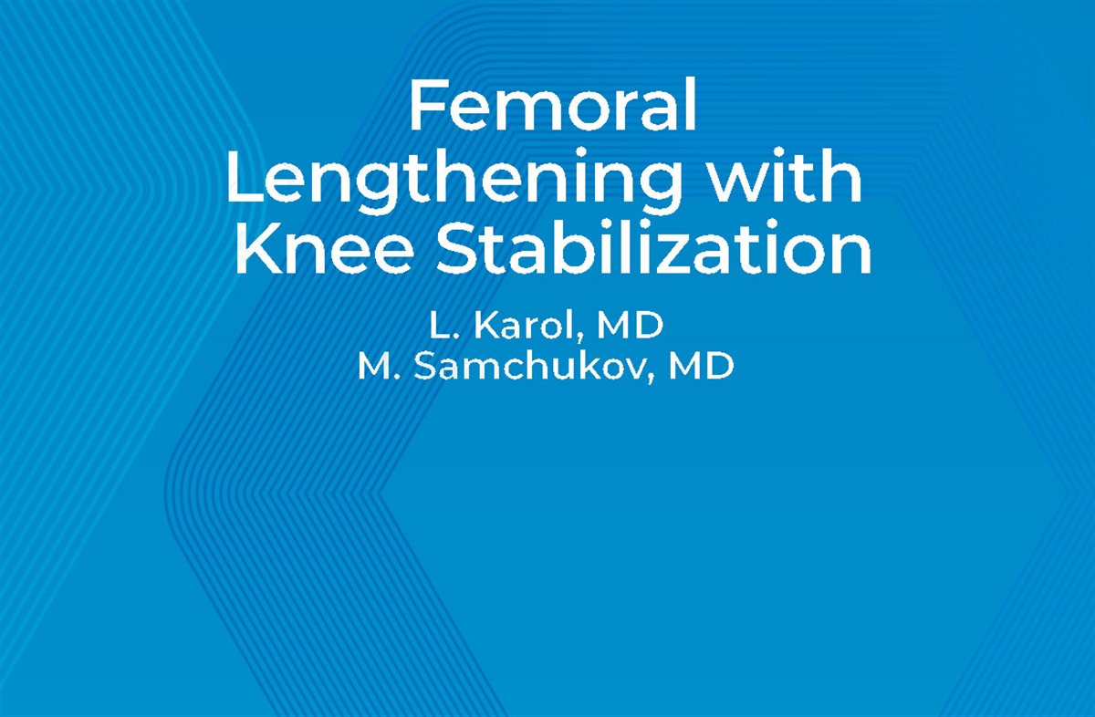 Femoral Lengthening with Knee Stabilization