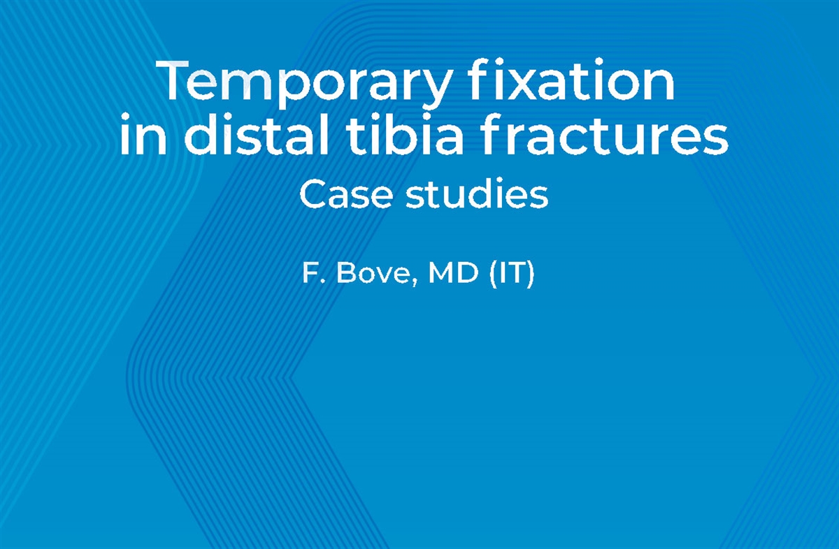 Temporary fixation in distal tibia fractures: case studies by Dr F Bove ...