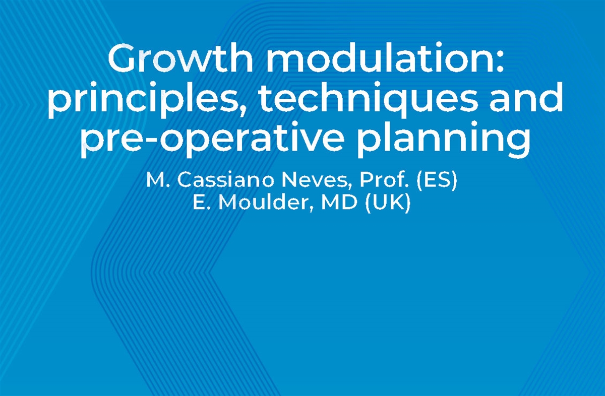 Growth modulation: principles, techniques and pre-operative planning
