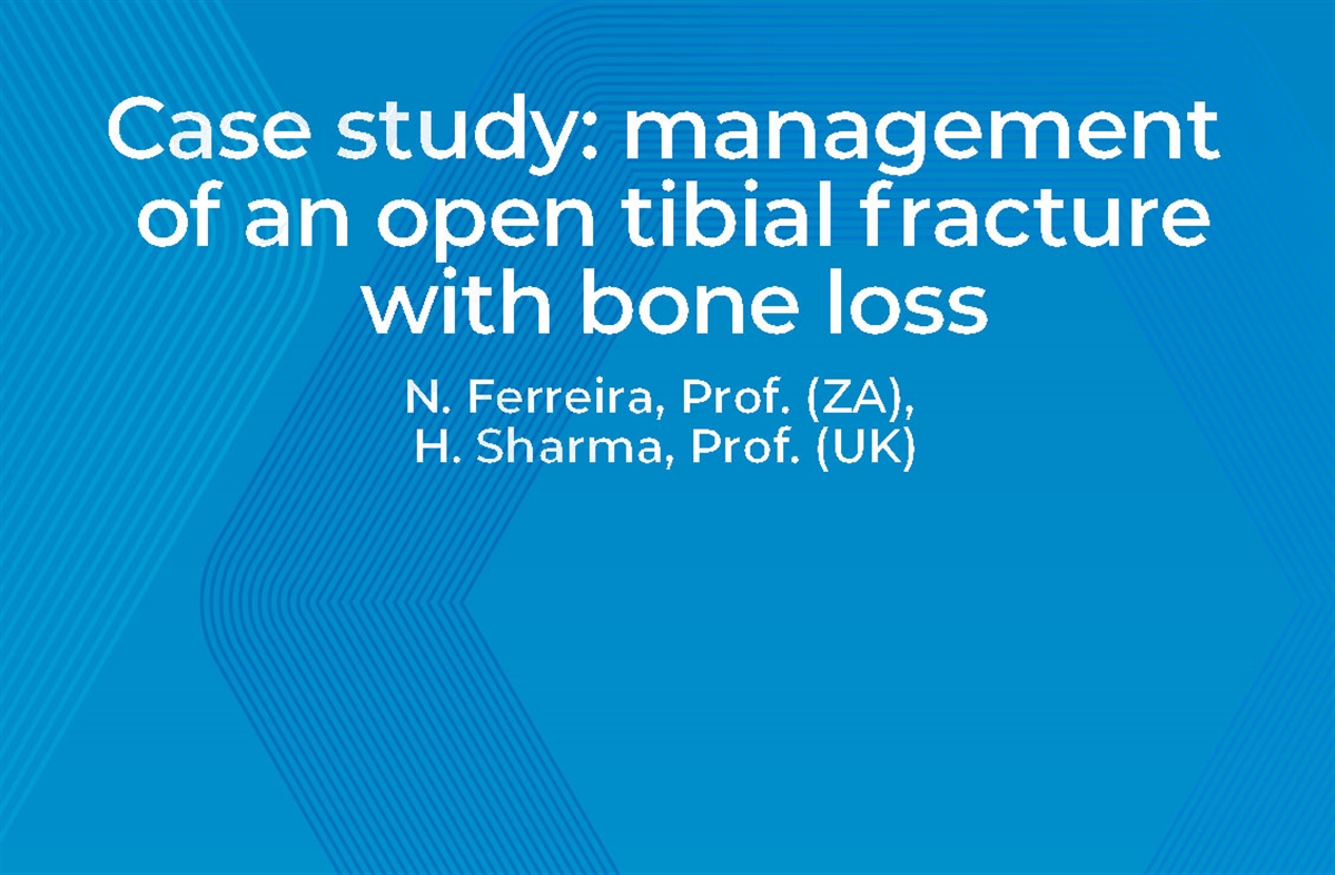 Case study: management of an open tibial fracture with bone loss
