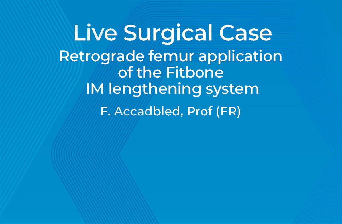 Live surgical case - Retrograde femur application of the Fitbone IM ...