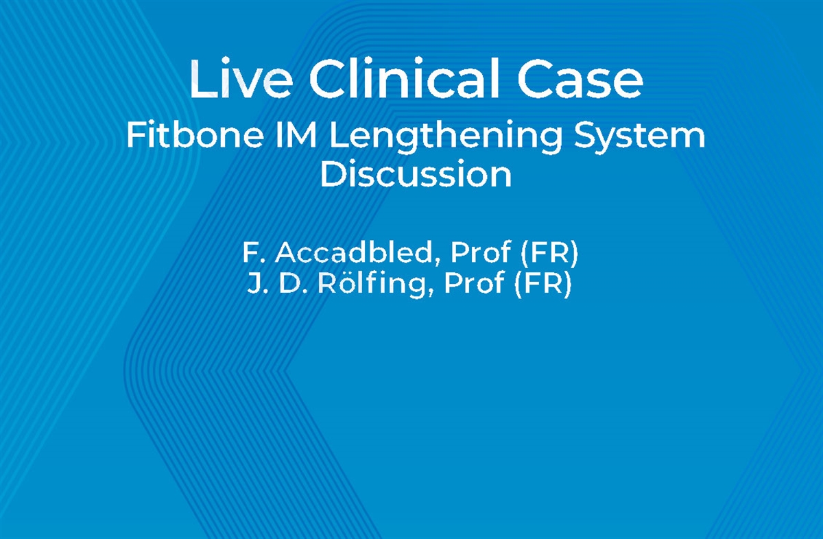 Live Q&A Session - Complex lengthening procedures with the Fitbone IM ...