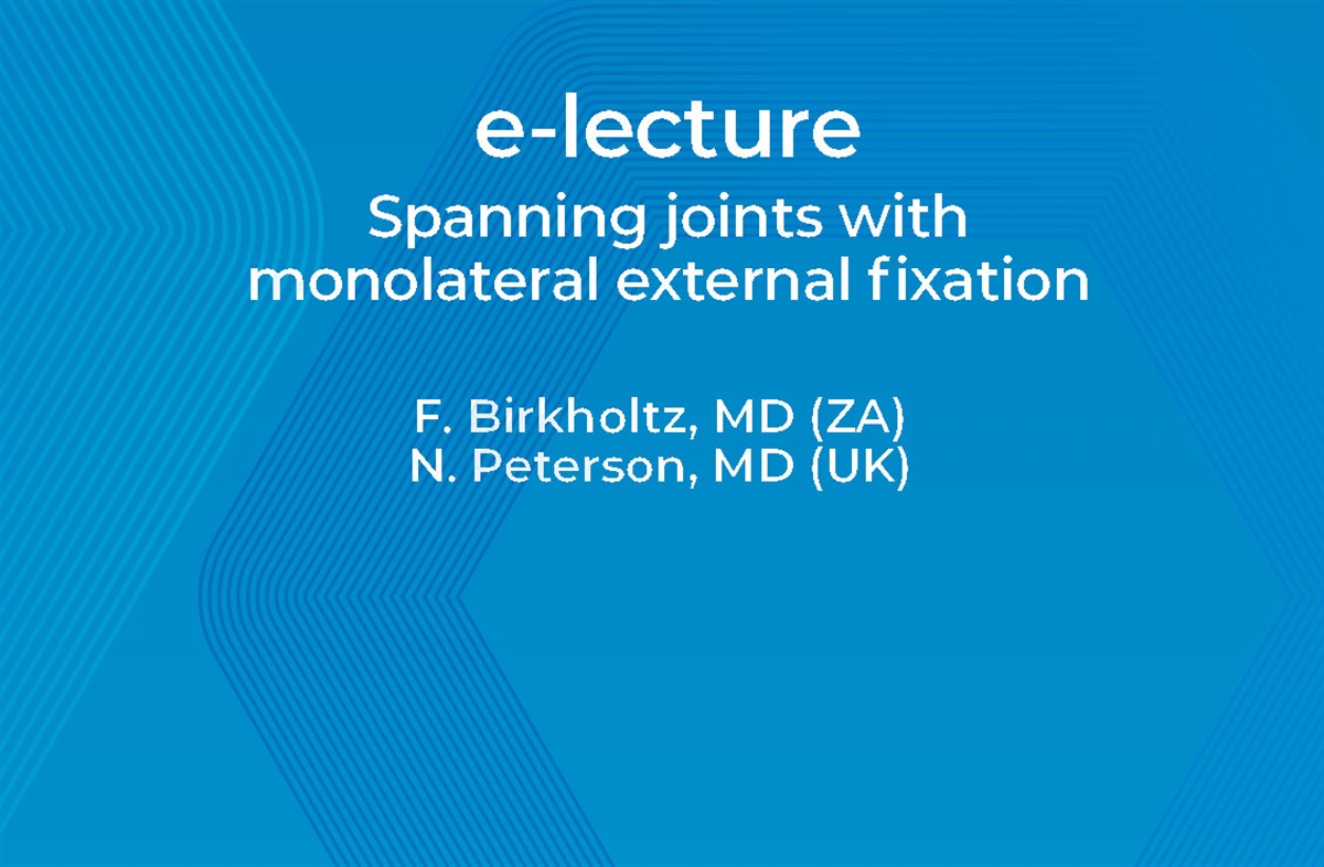 e-lecture - Spanning joints with monolateral external fixation