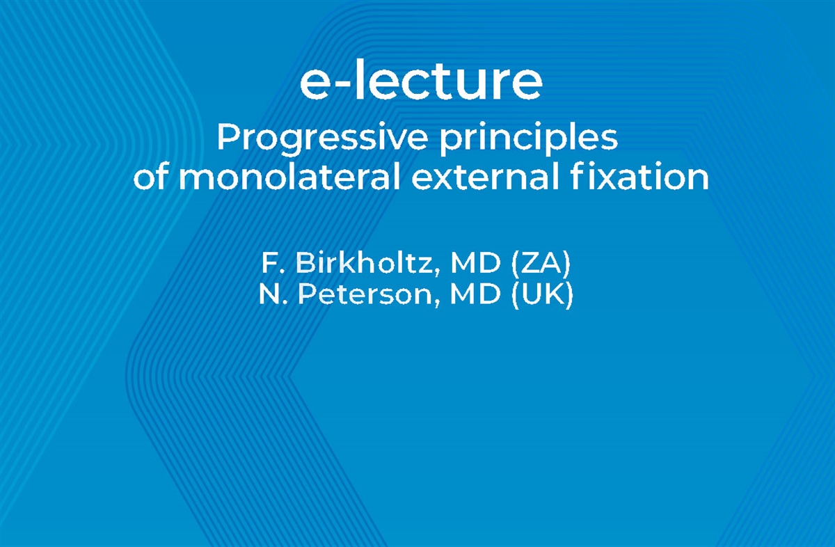e-lecture - Progressive principles of monolateral external fixation