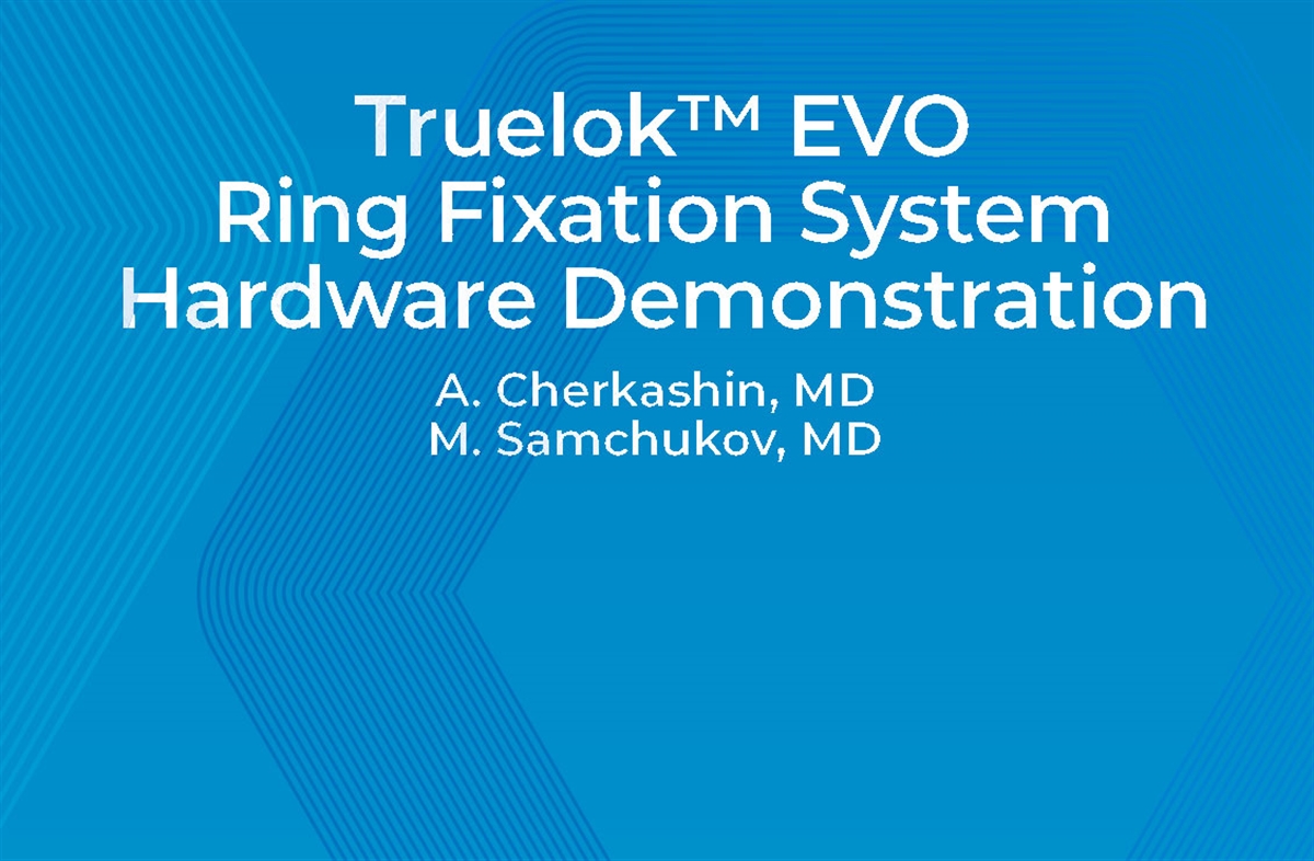 Truelok™ EVO Ring Fixation System Hardware Demonstration