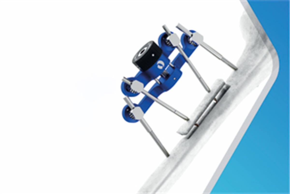 TrueLok Elevate Transverse Bone Transport System