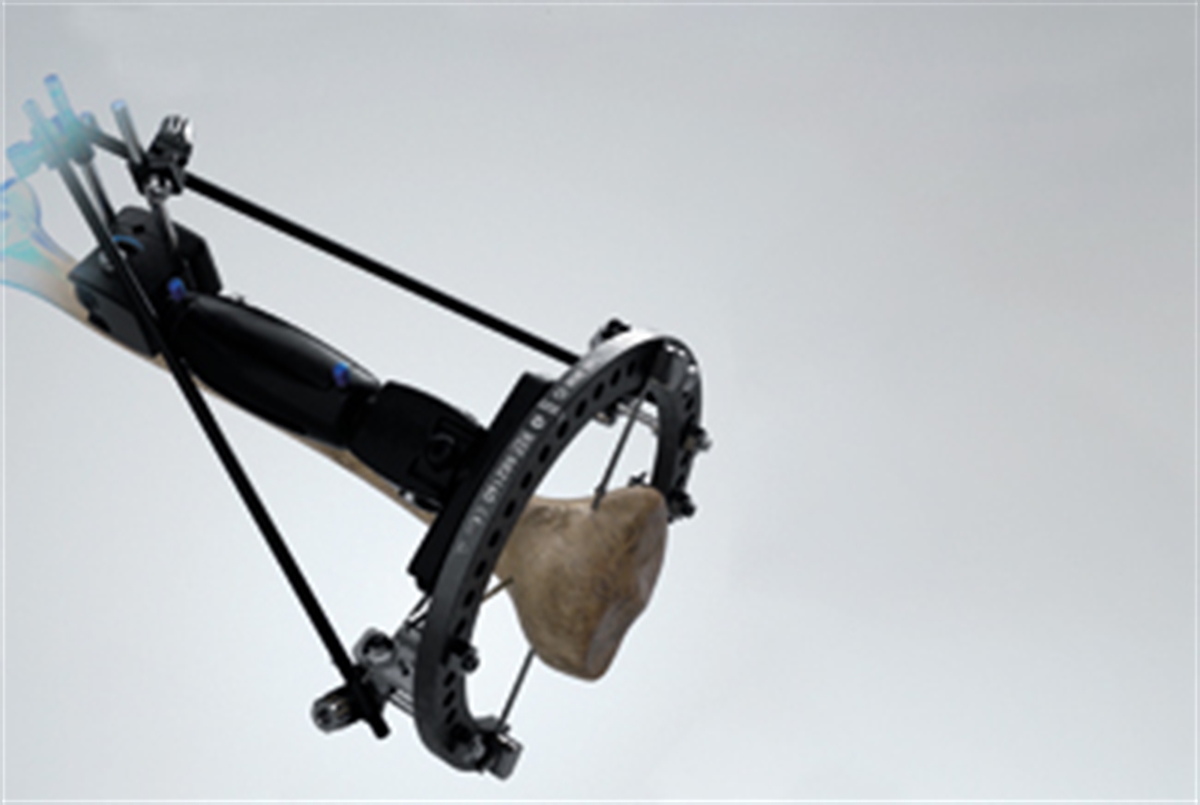 Truelok Evo XCaliber Hybrid System