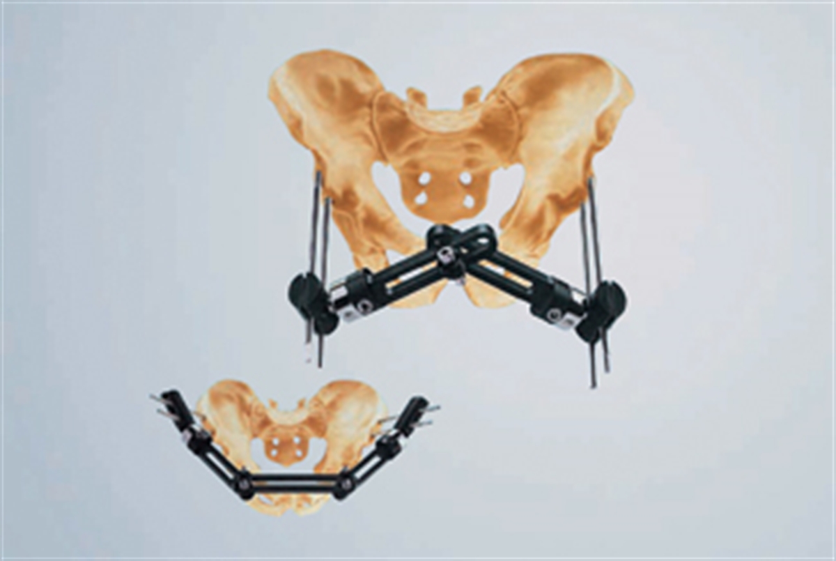 Pelvic Application