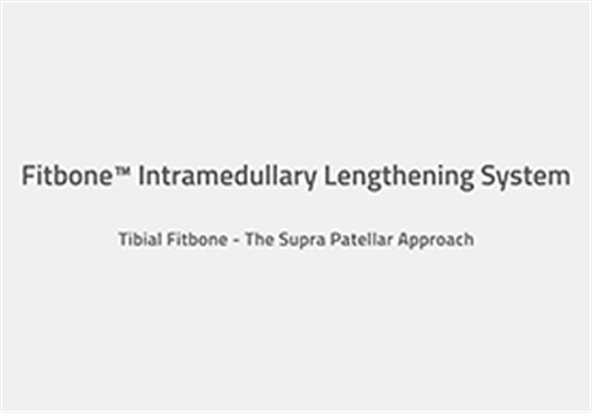 Fitbone Tibia: Supra Patellar Approach