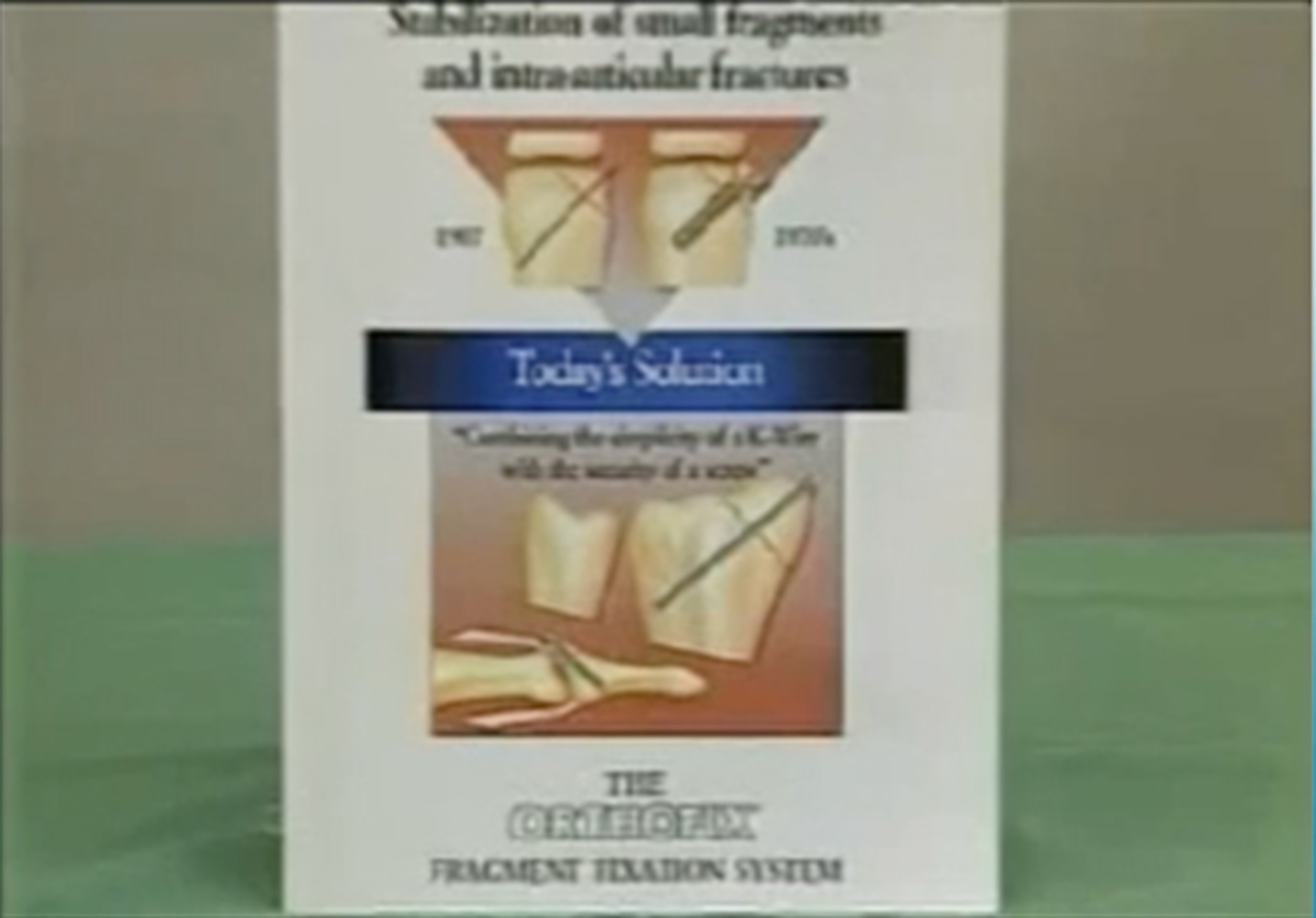 Fragment Fixation System Video