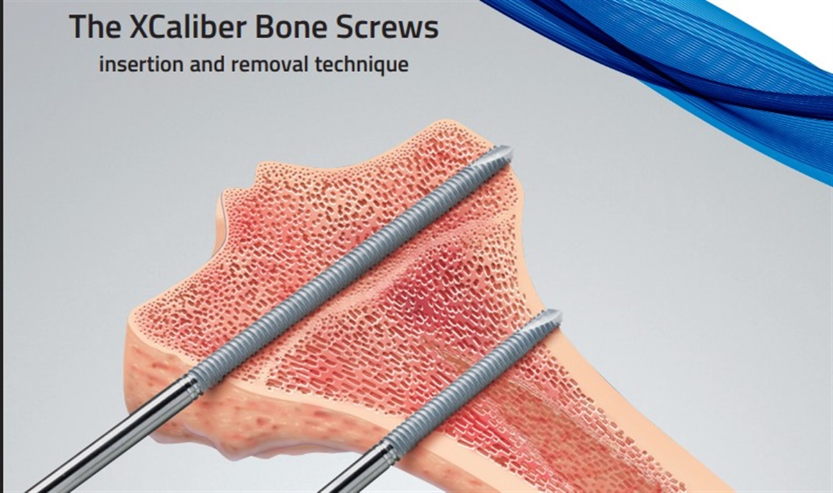 XCaliber Bone Screws Quick Reference Guide