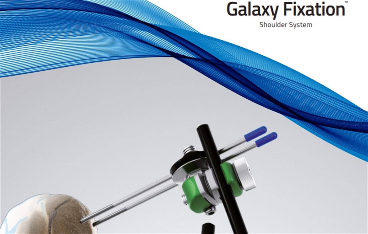 Galaxy Fixation Shoulder OpTech