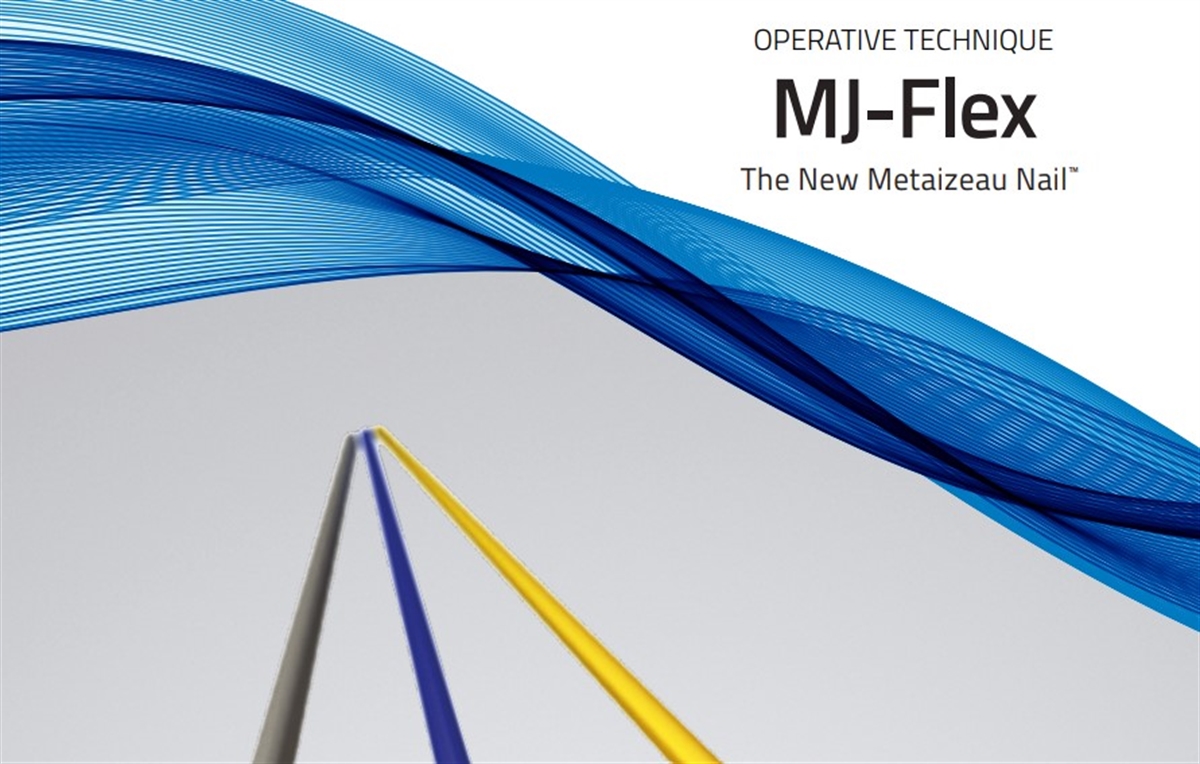 MJ-FLEX The new Metaizeau Nail Operative Technique