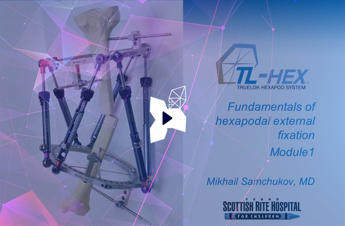 Fundamentals of hexapodal external fixation (module 1)