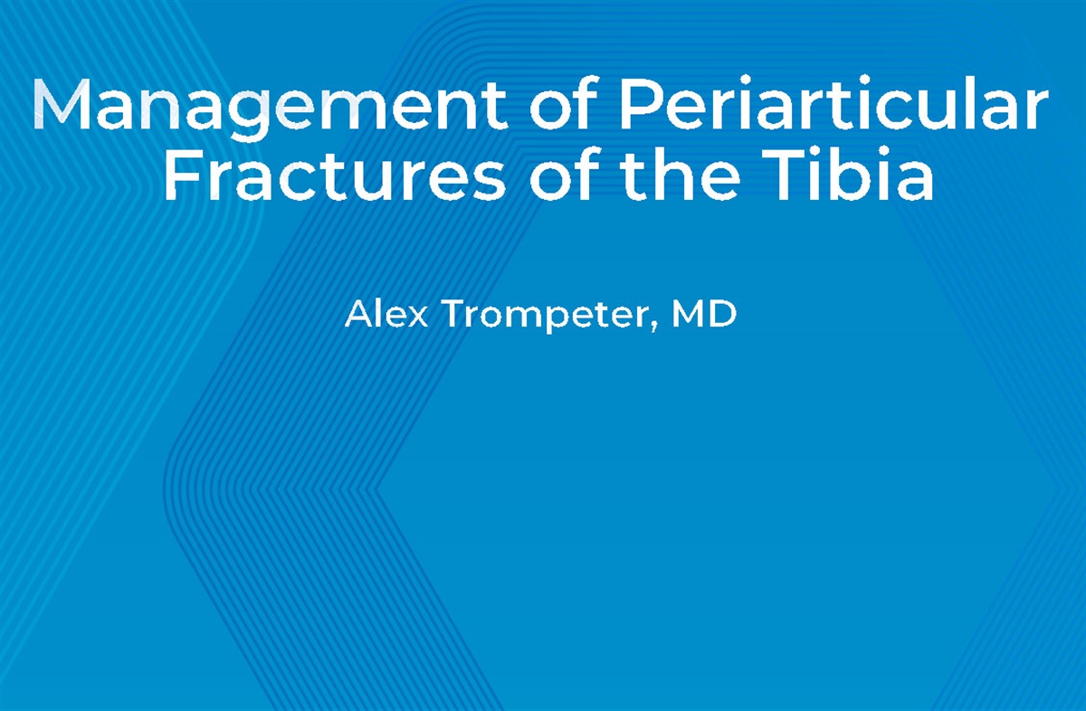 Management of Periarticular Fractures of the Tibia inlcuding Circular ...