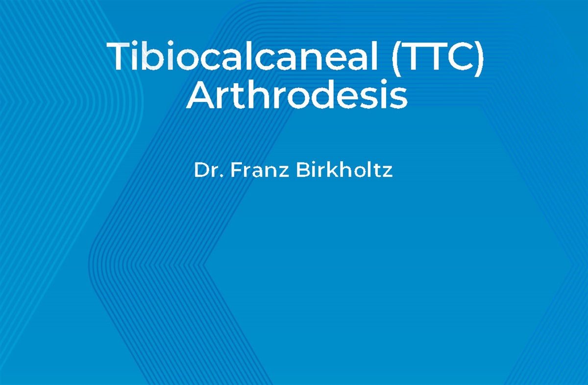 Tibiotalocalcaneal (TTC) arthrodesis