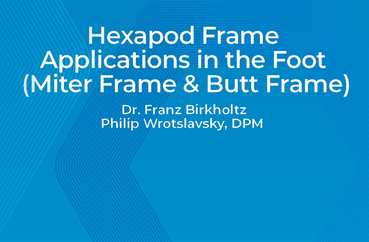 Hexapod frame applications in the foot (Miter frame and Butt frame)