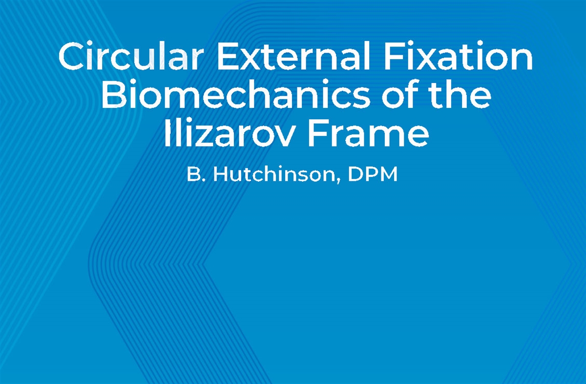 Circular External Fixation Biomechanics of the Ilizarov Frame